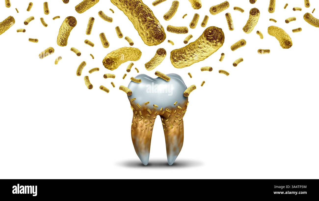 Bacteria tooth infection and teeth decay disease as an unhealthy molar ...