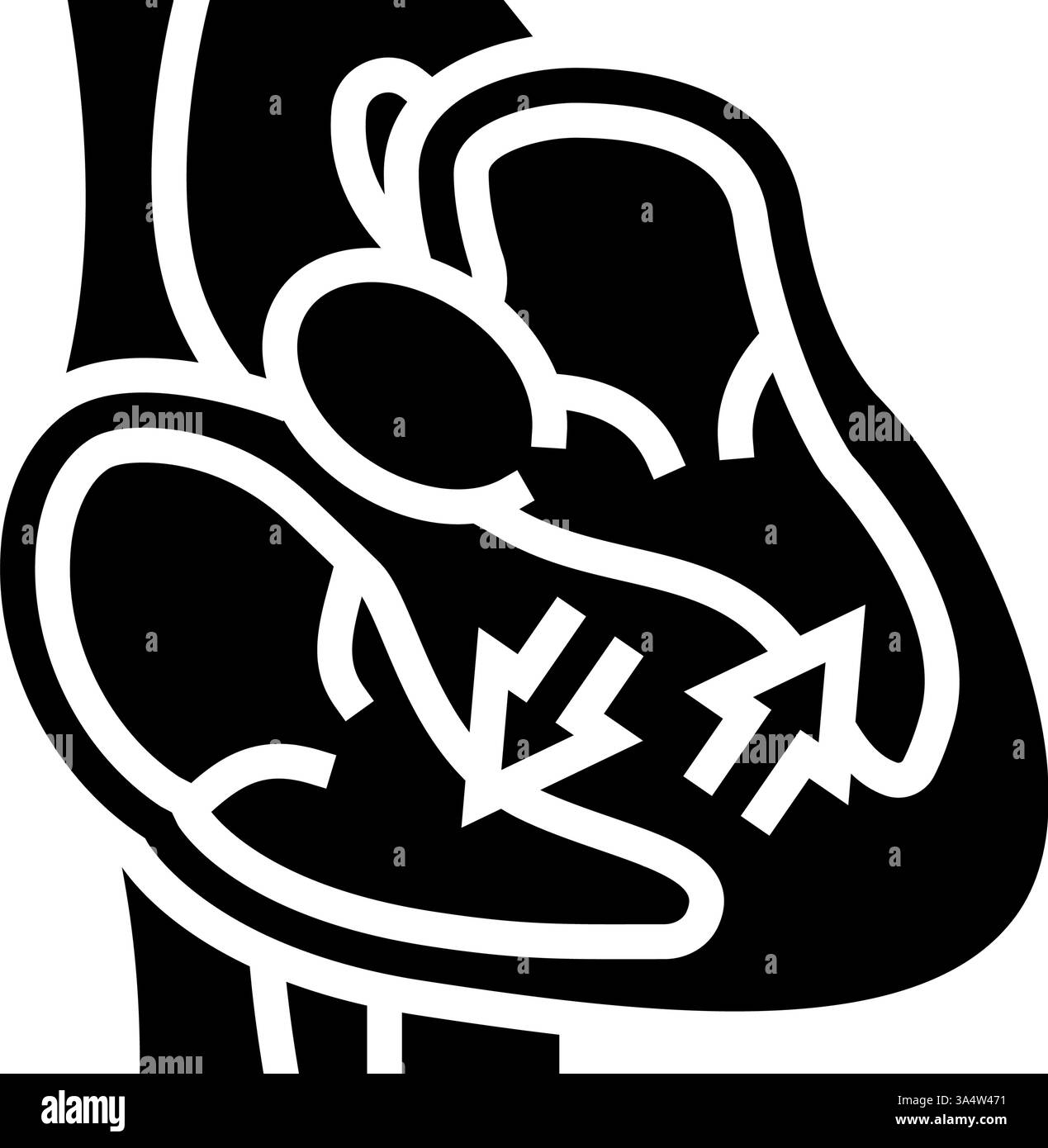 hypertrophic cardiomyopathy cardiology glyph icon vector illustration ...