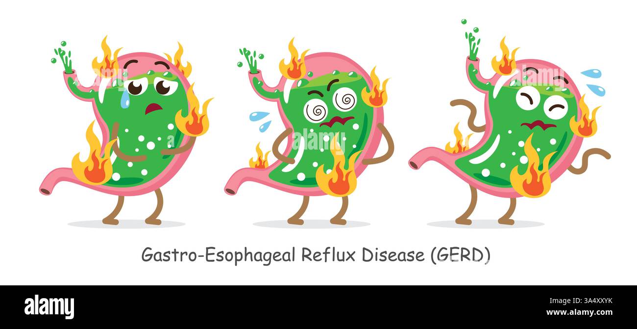 Gastroesophageal reflux disease . GERD . Set of stomach with facial ...