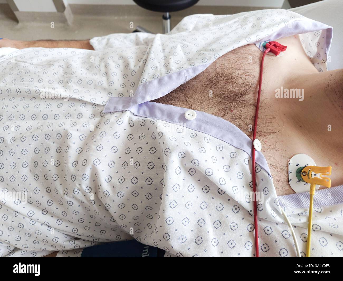 ECG or EKG or electrocardiogram electrodes connected to a Caucasian man's chest. Lying in ...