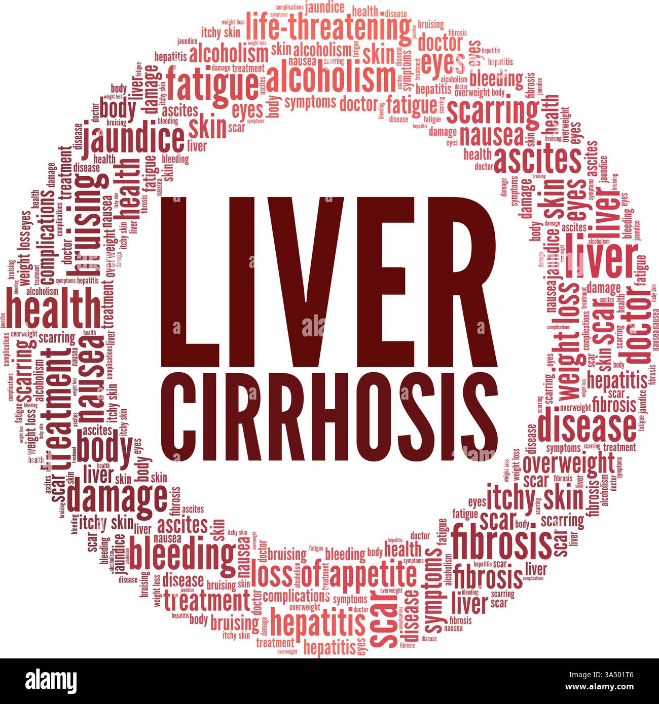 Liver Cirrhosis vector illustration word cloud isolated on white ...