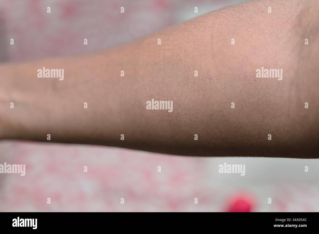 A close-up view of a human arm displays skin texture, showcasing the ...