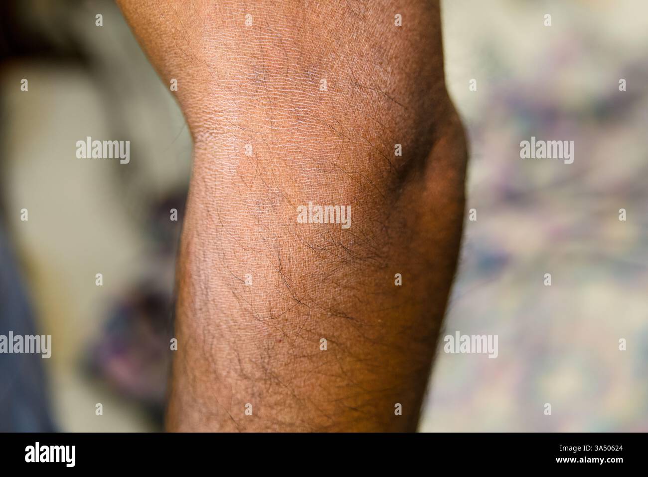 Detailed view of skin texture on a human elbow highlighting hair and ...