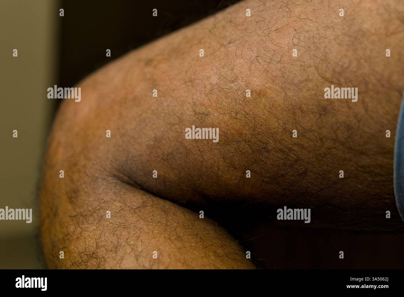 A close-up view shows a man's knee with detailed hair texture in a ...
