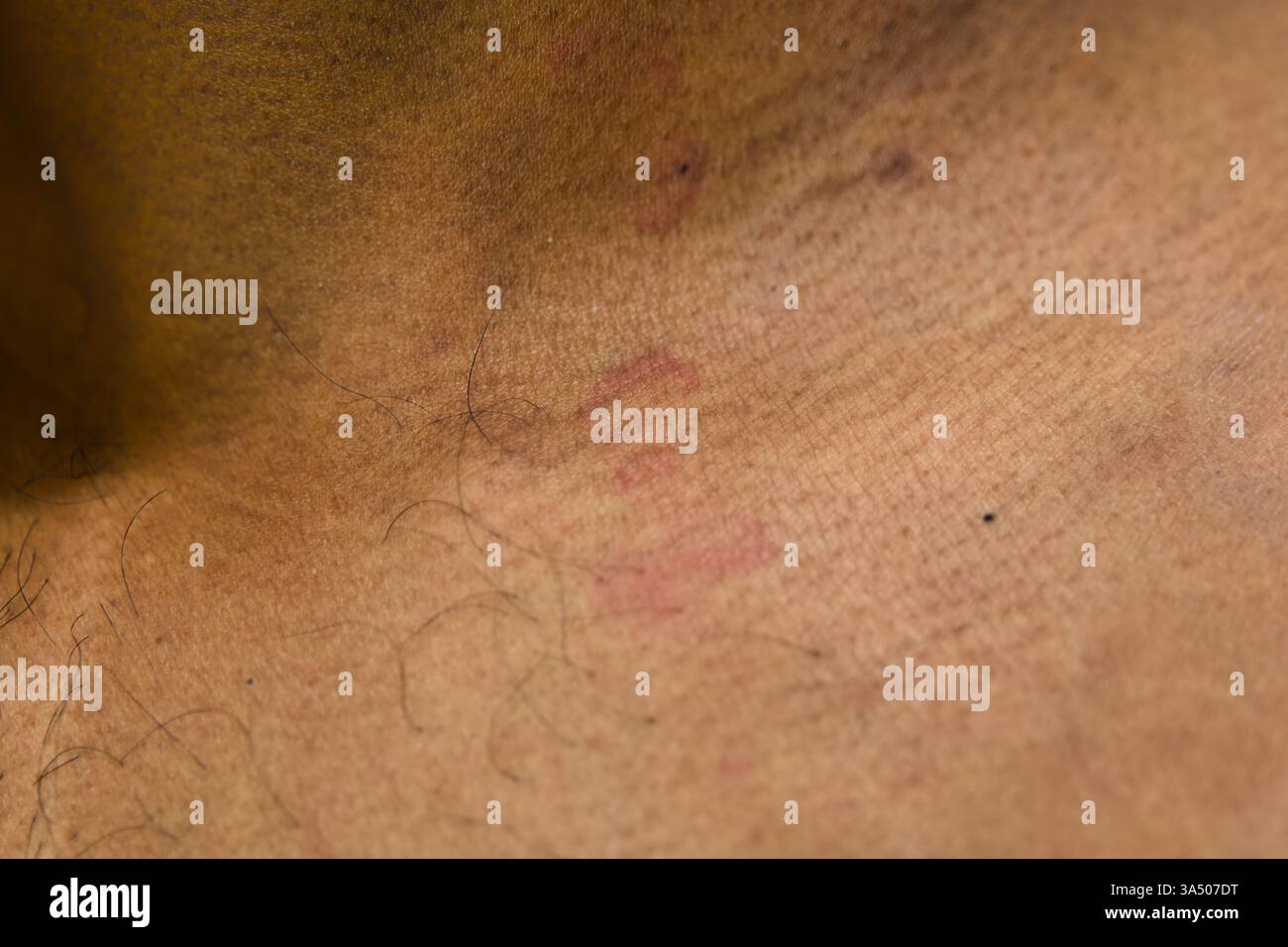 Skin shows visible marks and redness after an intense workout session ...
