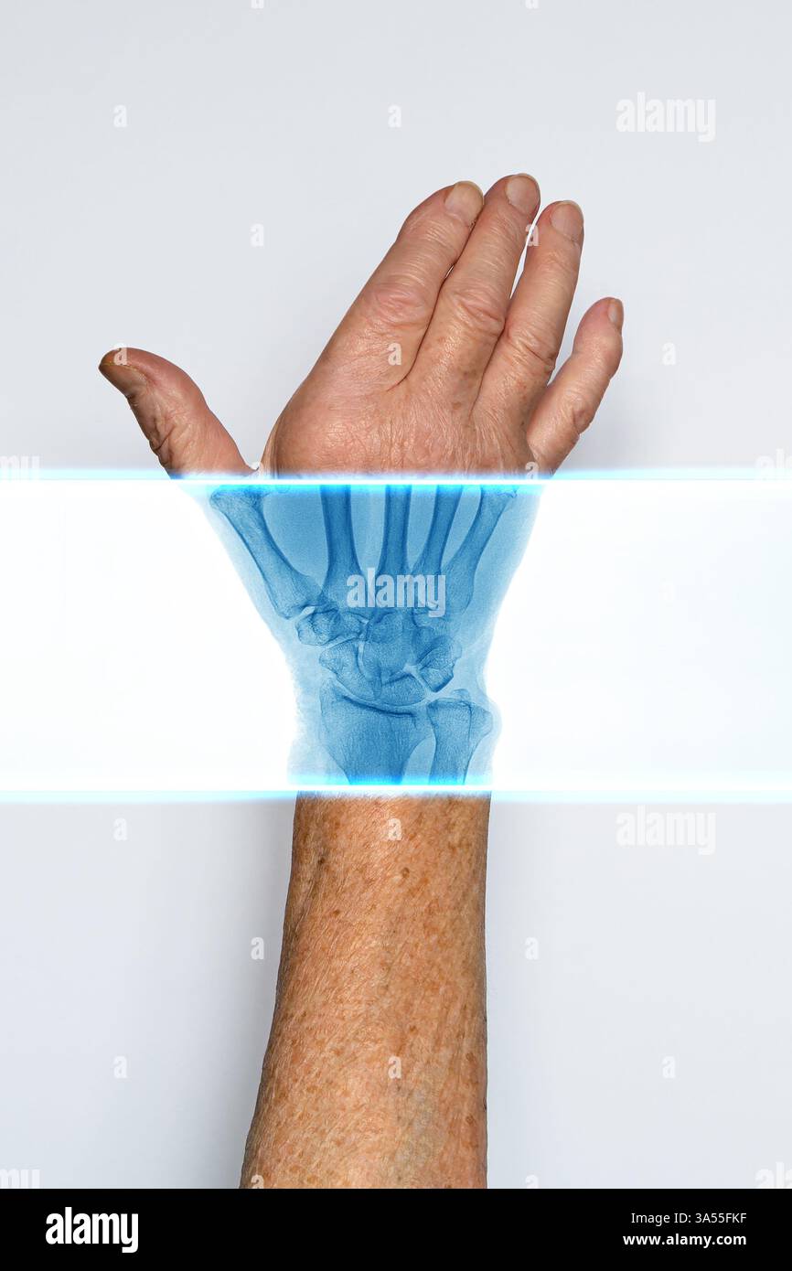 Close-up of an elderly woman's hand on white, transitioning into an X ...