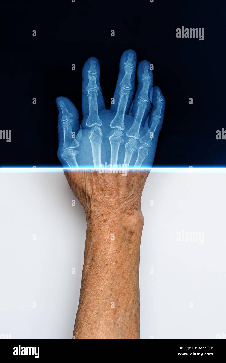 Close-up of an elderly woman's hand on white, transitioning into an X ...