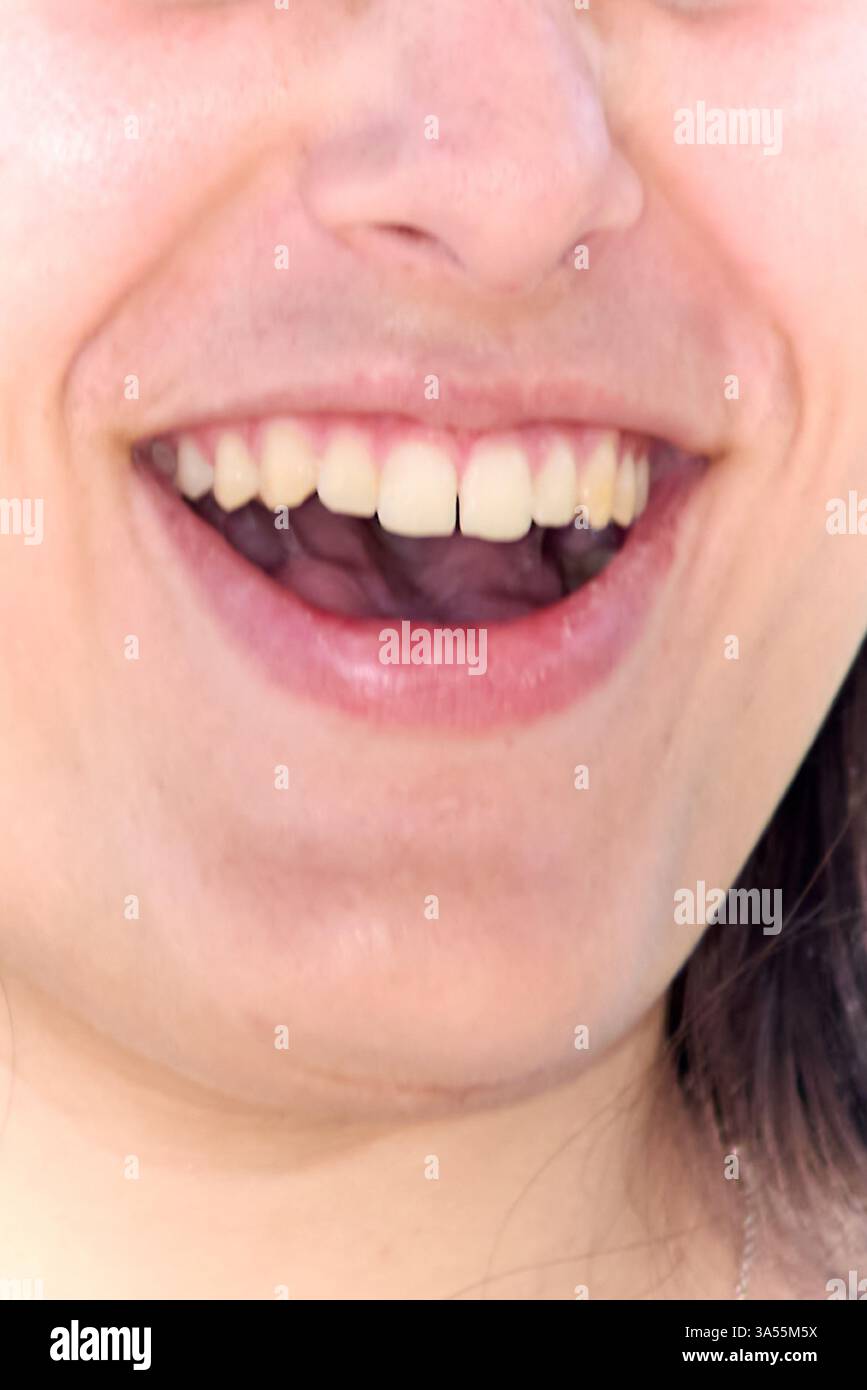 Close-up of a smiling mouth with clean teeth. Bright lighting ...