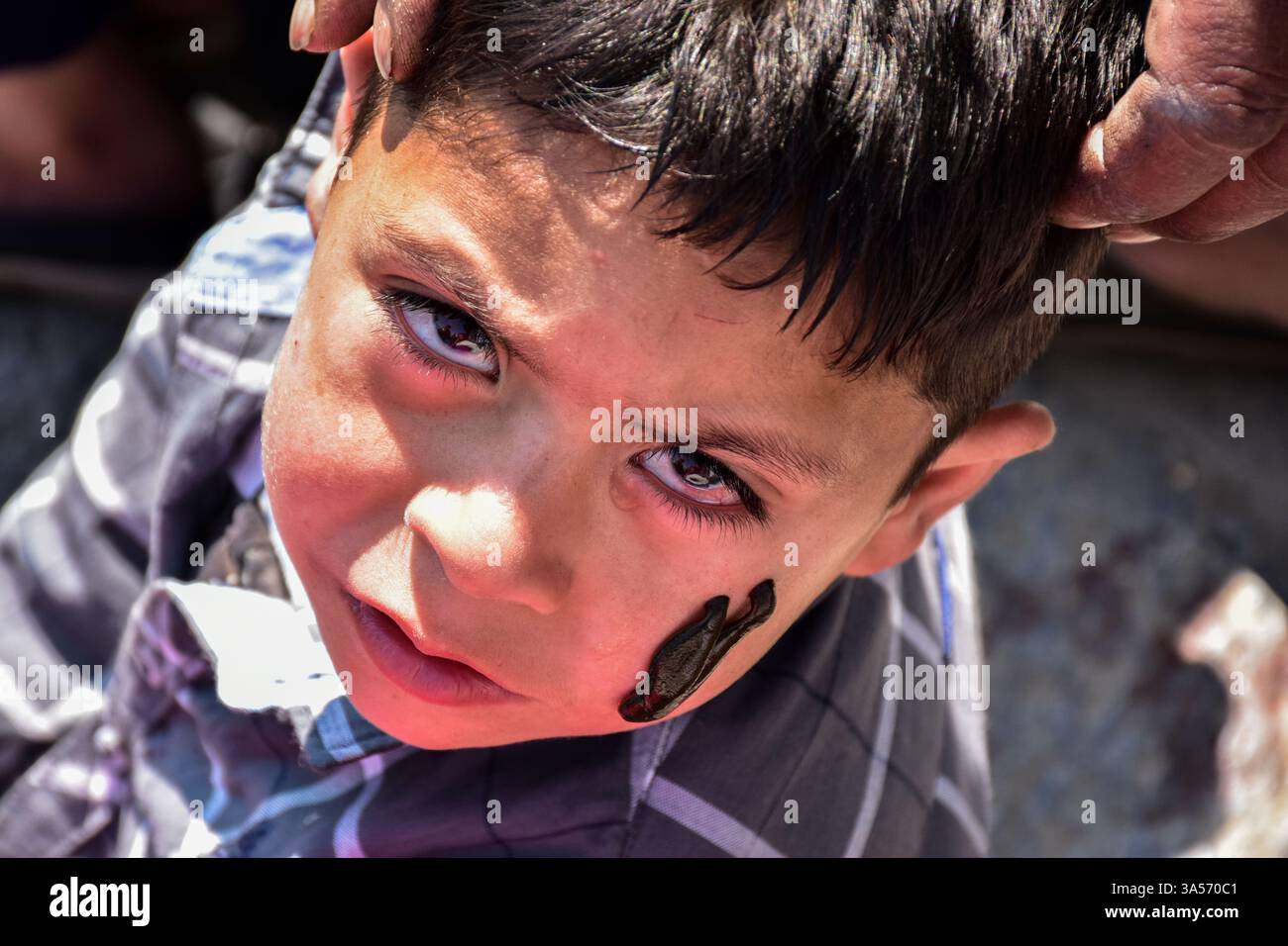 A young boy receives leech therapy on his face on Nowruz, the day which ...