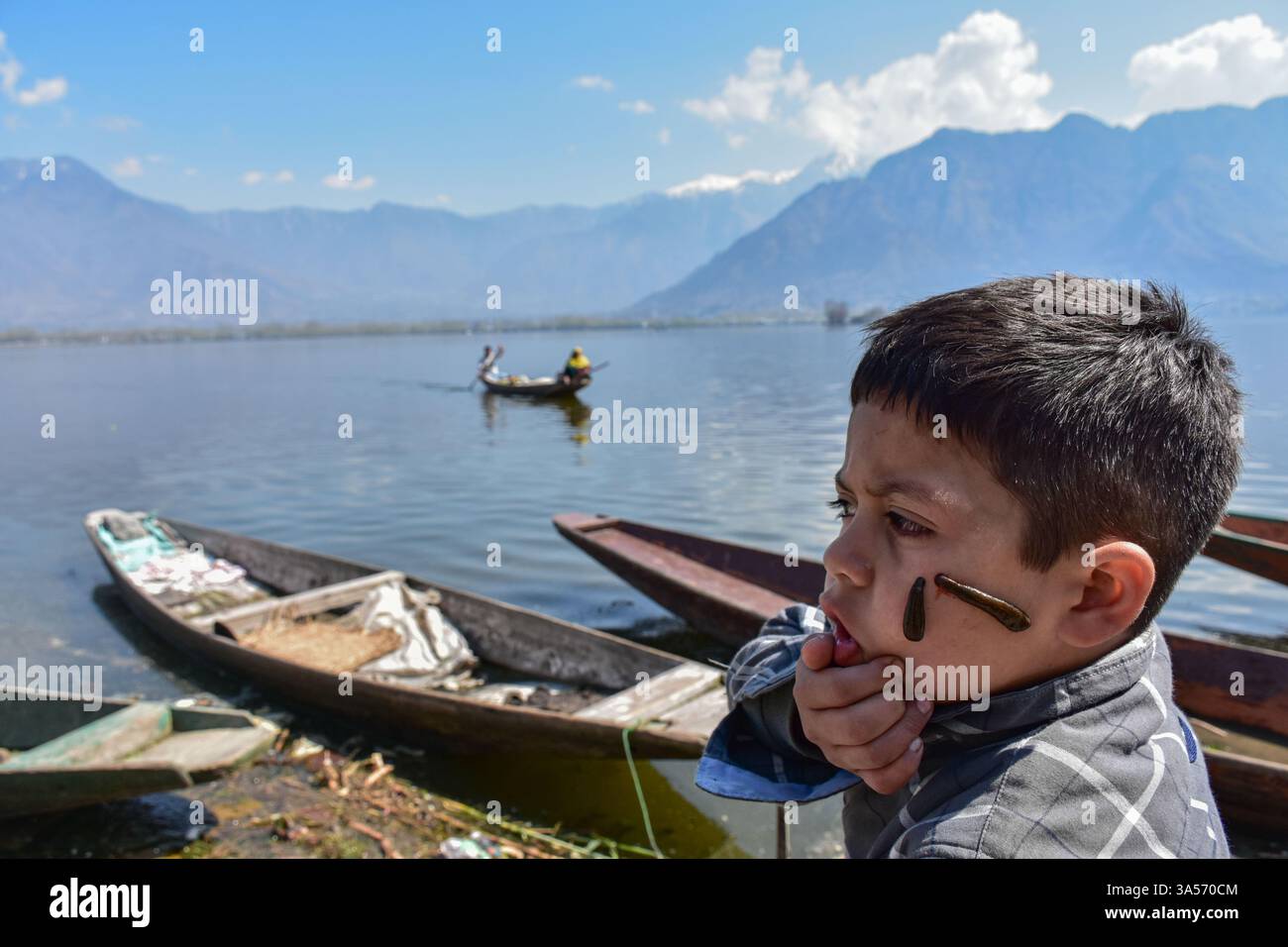 A young boy reacts as he receives leech therapy on his face on Nowruz ...