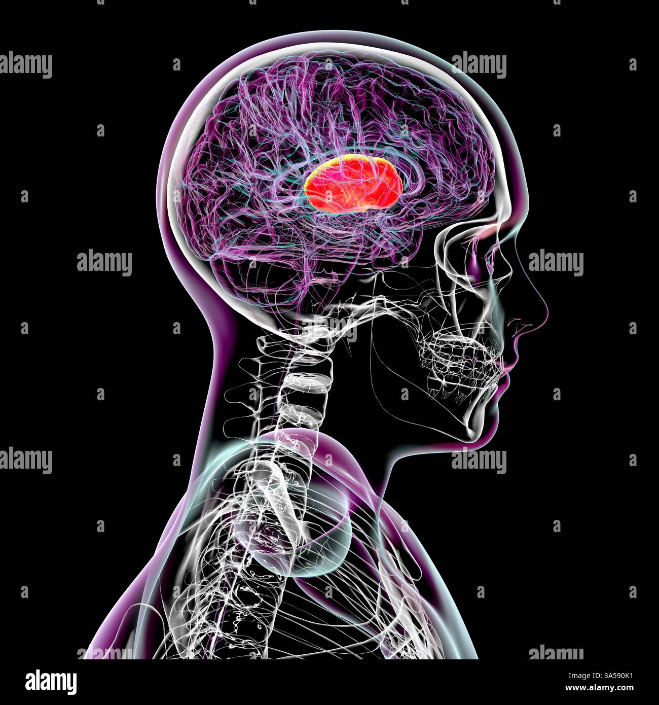Illustration of the human brain with a highlighted internal capsule ...