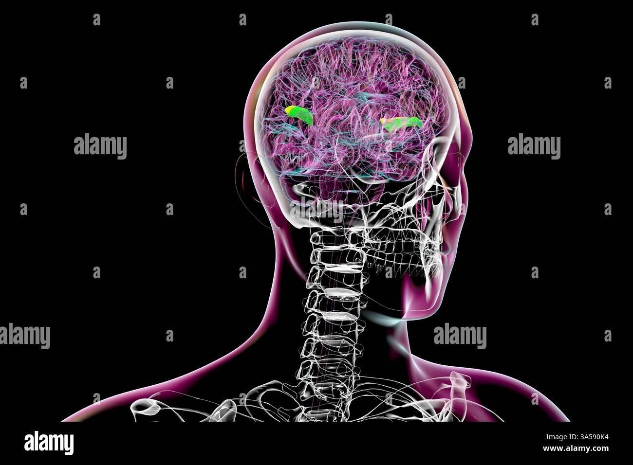 Illustration of the human brain with the transverse temporal gyri ...
