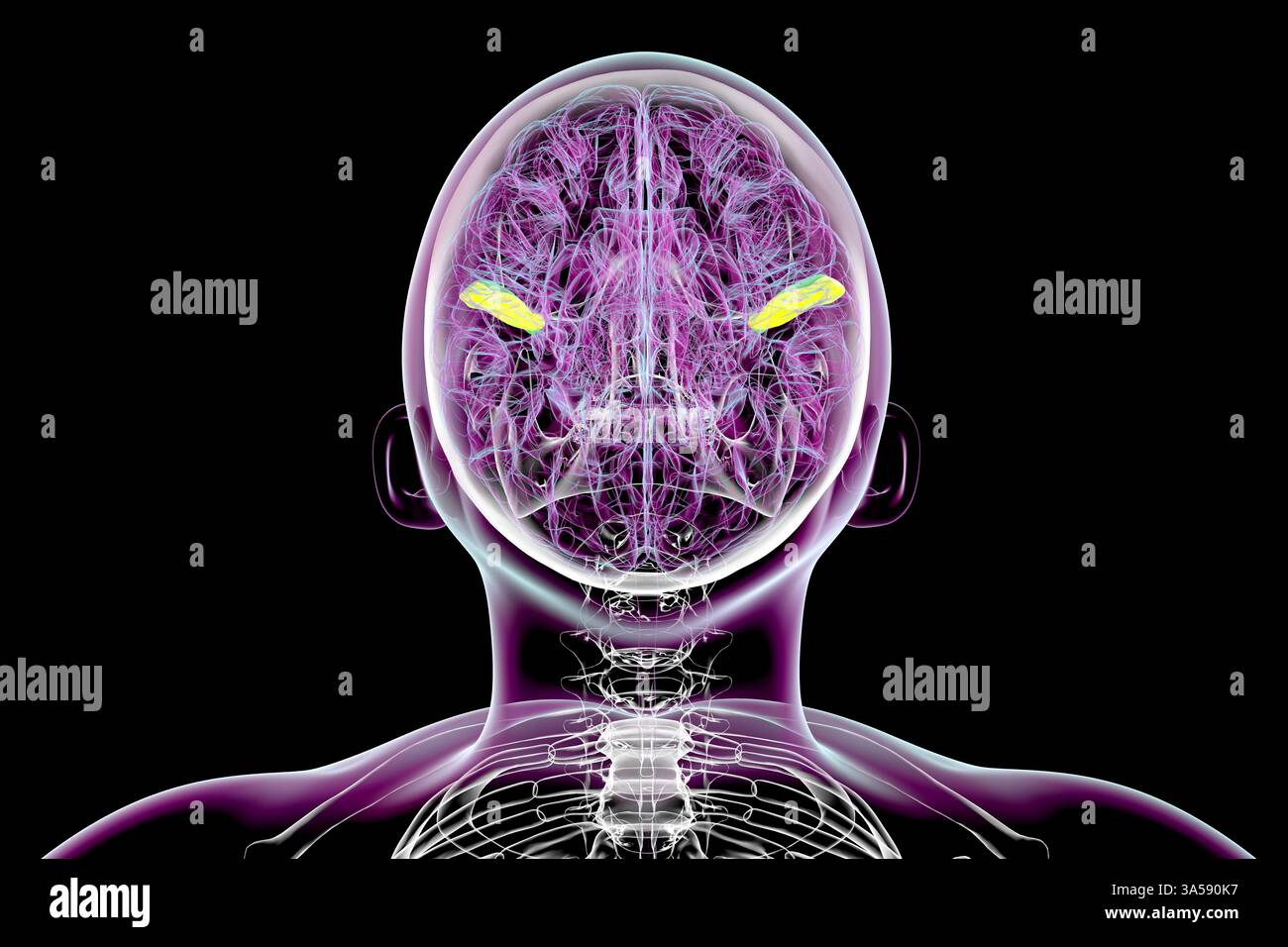 Illustration of the human brain with the transverse temporal gyri ...
