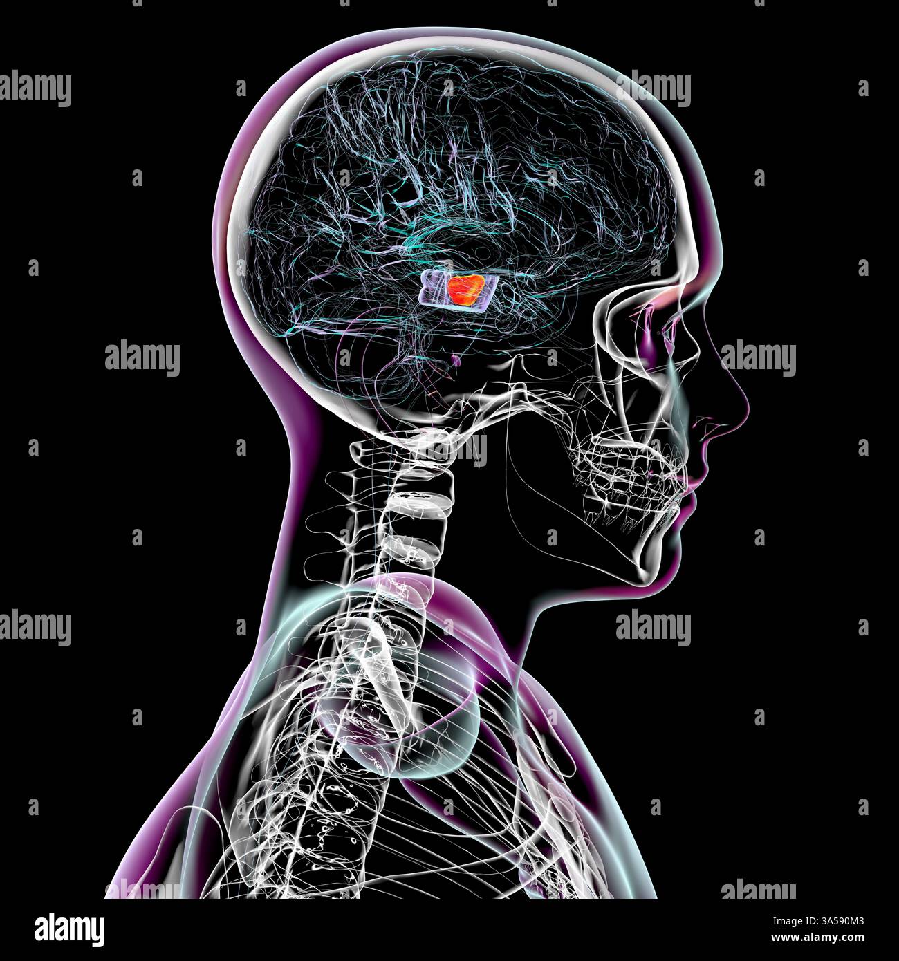 Illustration of the human brain with a highlighted substantia nigra ...