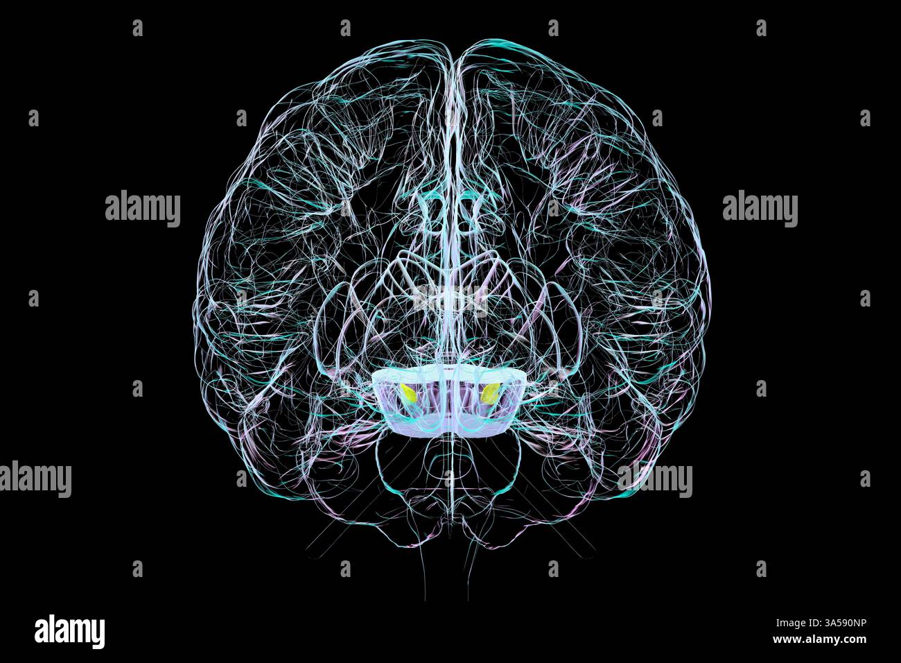 Illustration of the human brain with an atrophic substantia nigra ...