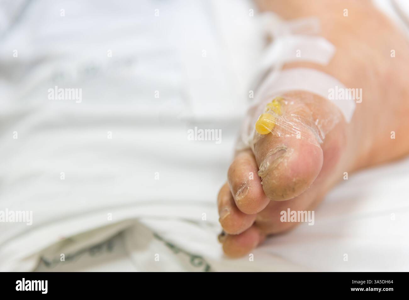 Patient asian elder women 80s with saline intravenous at C-line or A ...