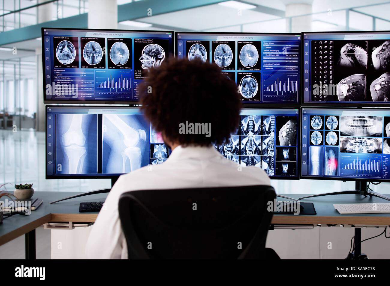 African american patient analyzing brain hi-res stock photography and ...