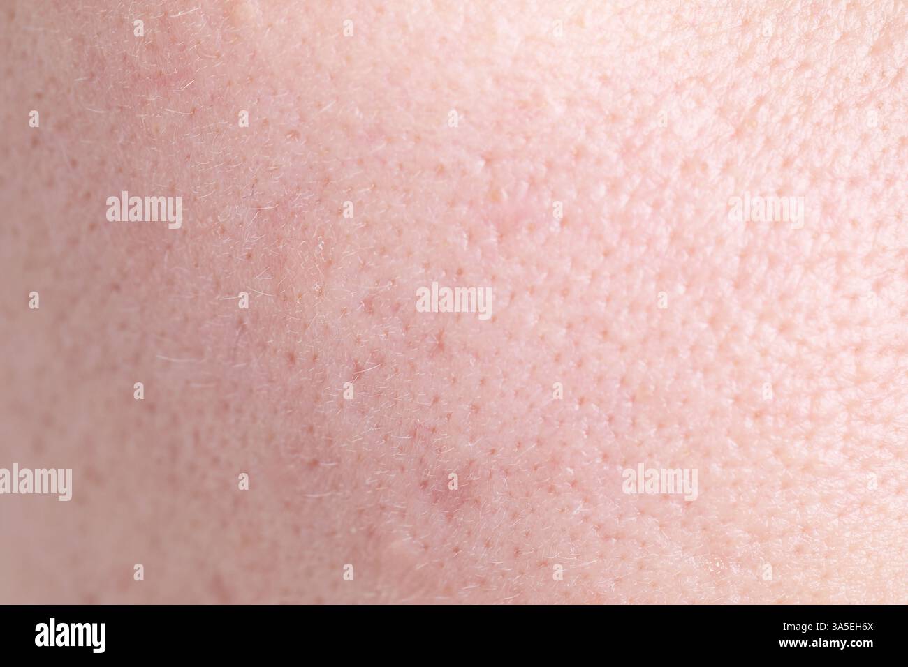 Texture of skin with enlarged pores as background, closeup Stock Photo ...