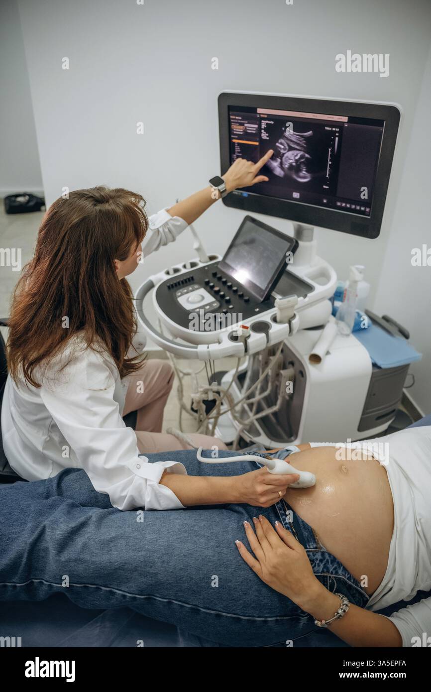 Monitor with graphical representation of scan. Pregnant woman ...