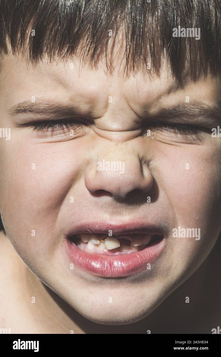 Child shows missing teeth. Child face Stock Photo - Alamy