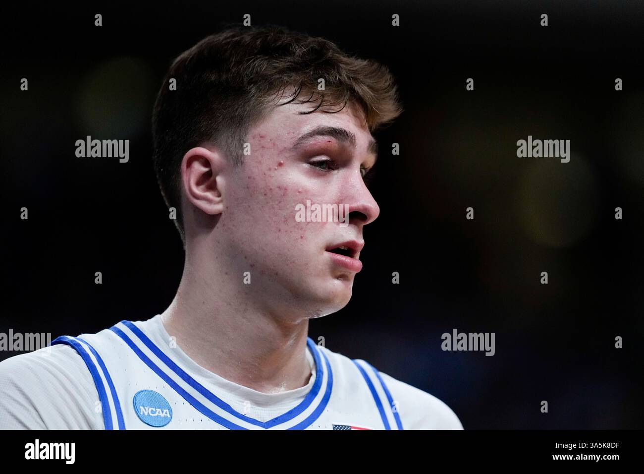 A cut is visible above Duke forward Cooper Flagg's right eye after an ...