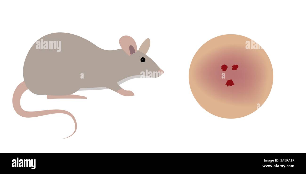 Rat bite fever Stock Vector Images - Alamy
