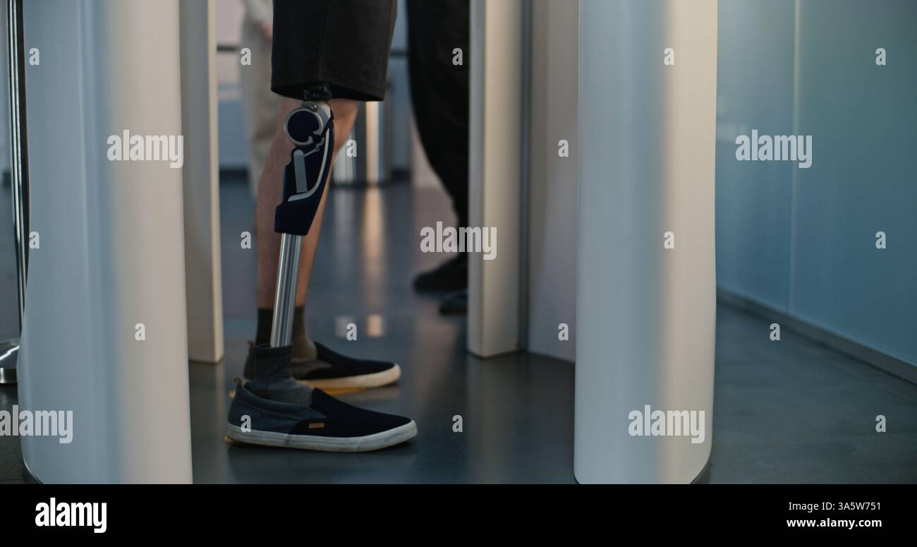 Diverse Travelers at Security Checkpoint: Man with Prosthetic Leg and ...