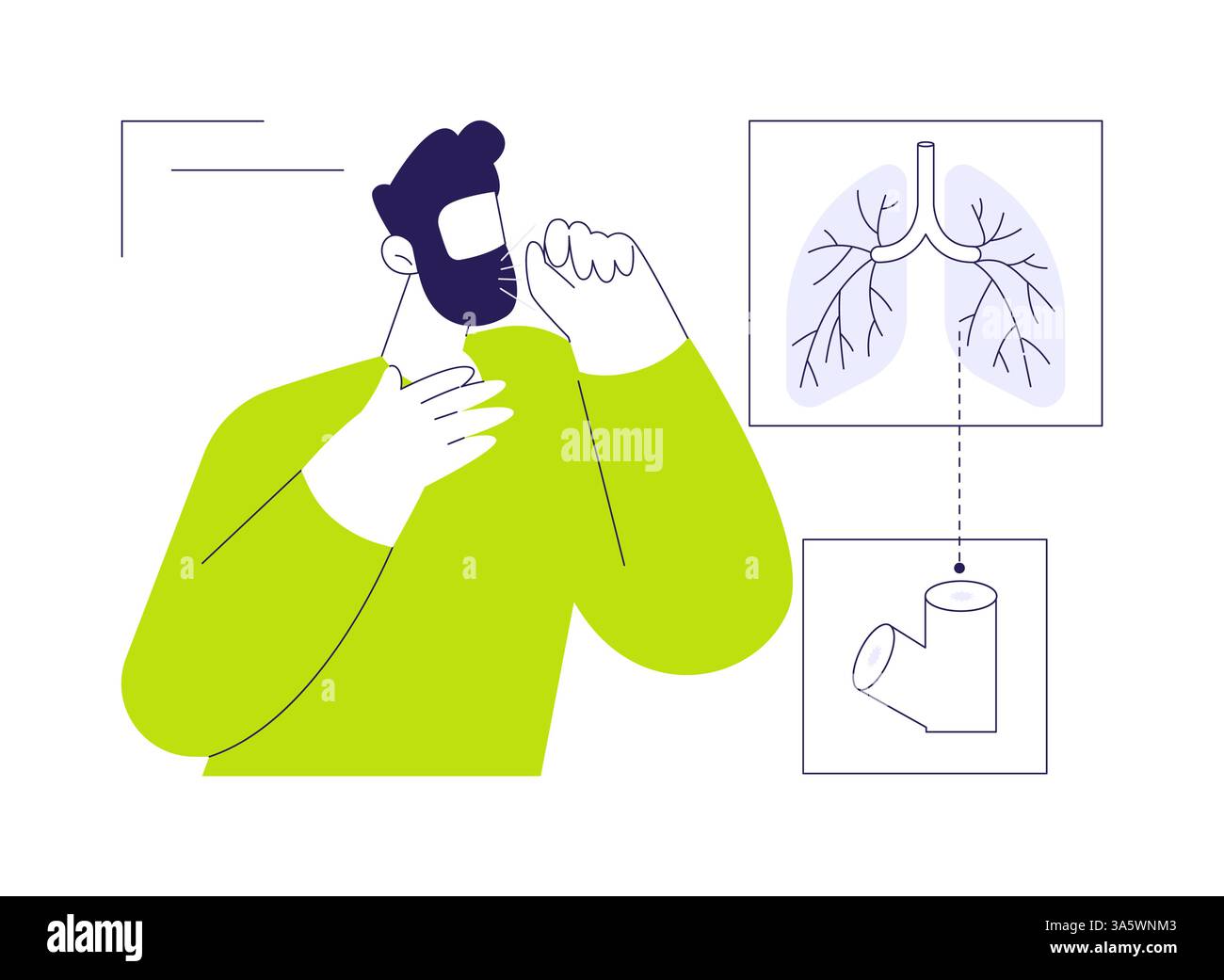 Bronchitis symptoms abstract concept vector illustration Stock Vector ...