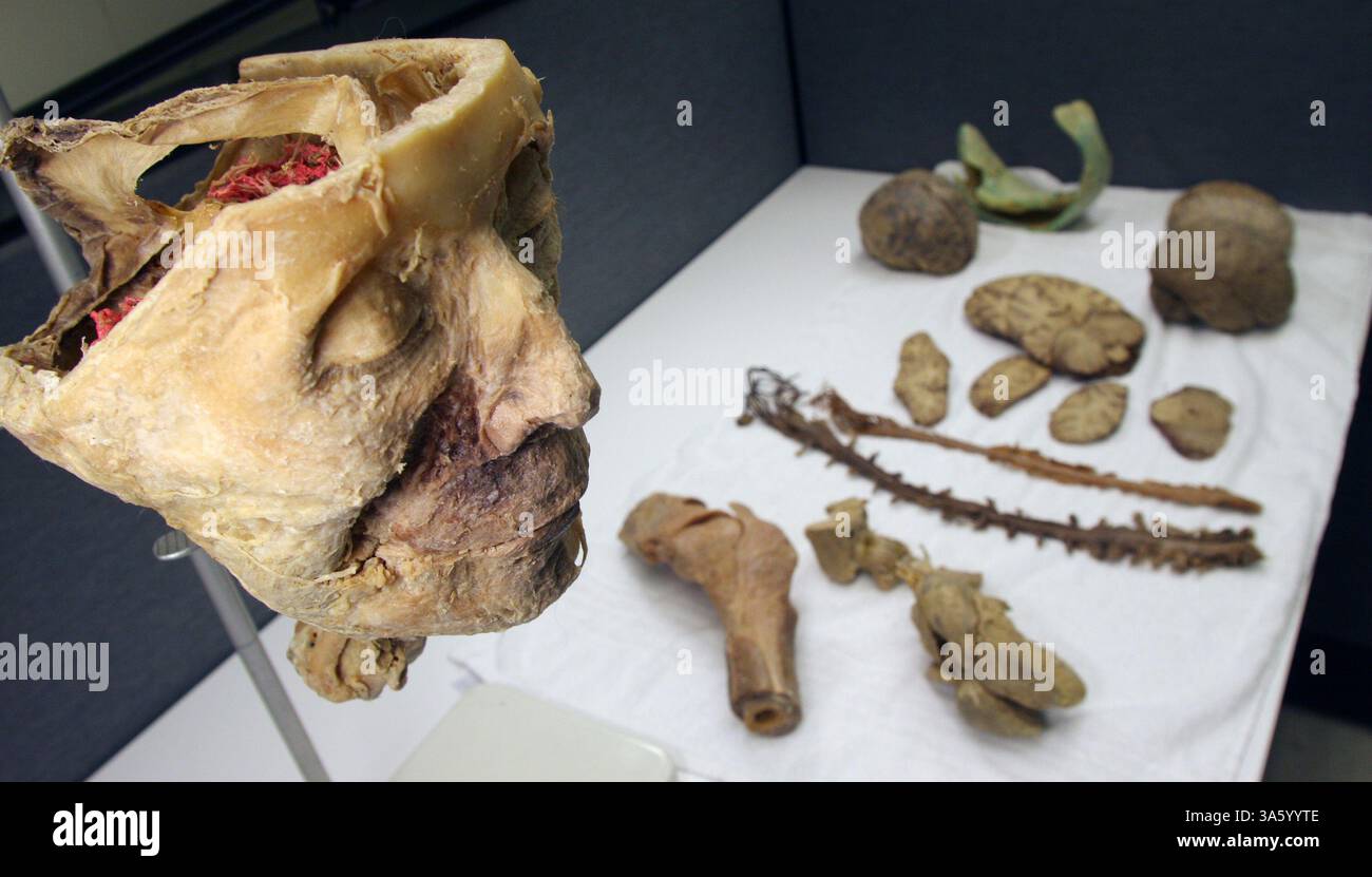 June 24, 2008 - Preserved human body parts that have been through the ...