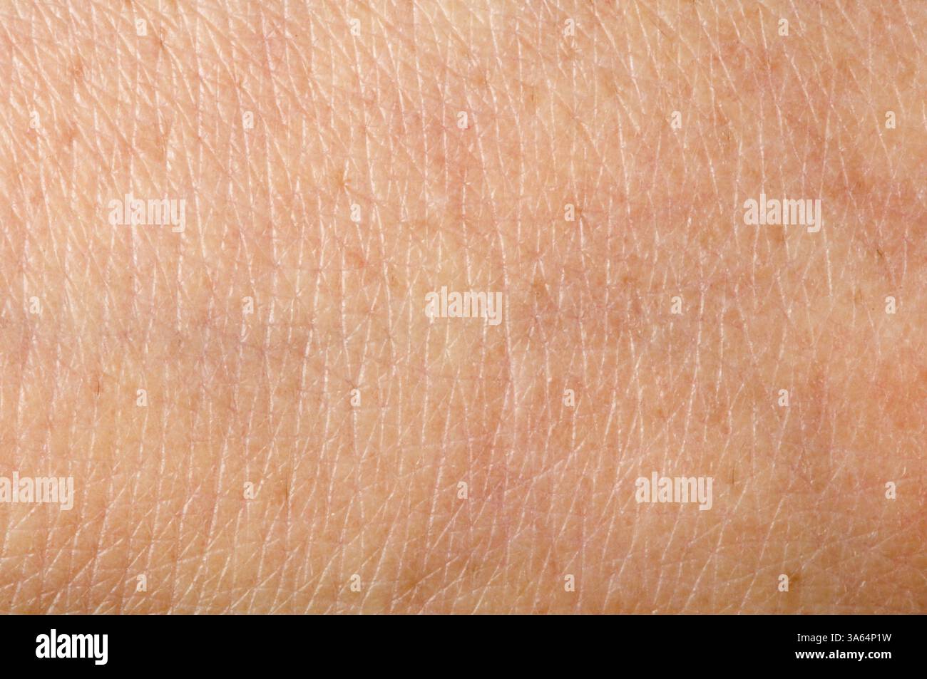 Human skin close up. Structure of Skin Stock Photo - Alamy