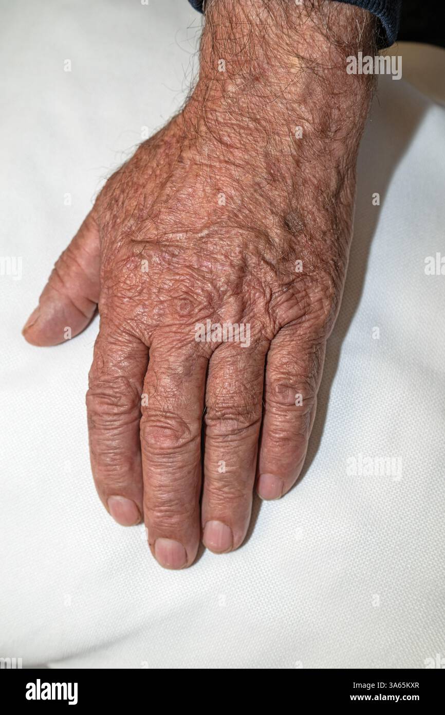 Wrinkled skin tissue in hi-res stock photography and images - Alamy