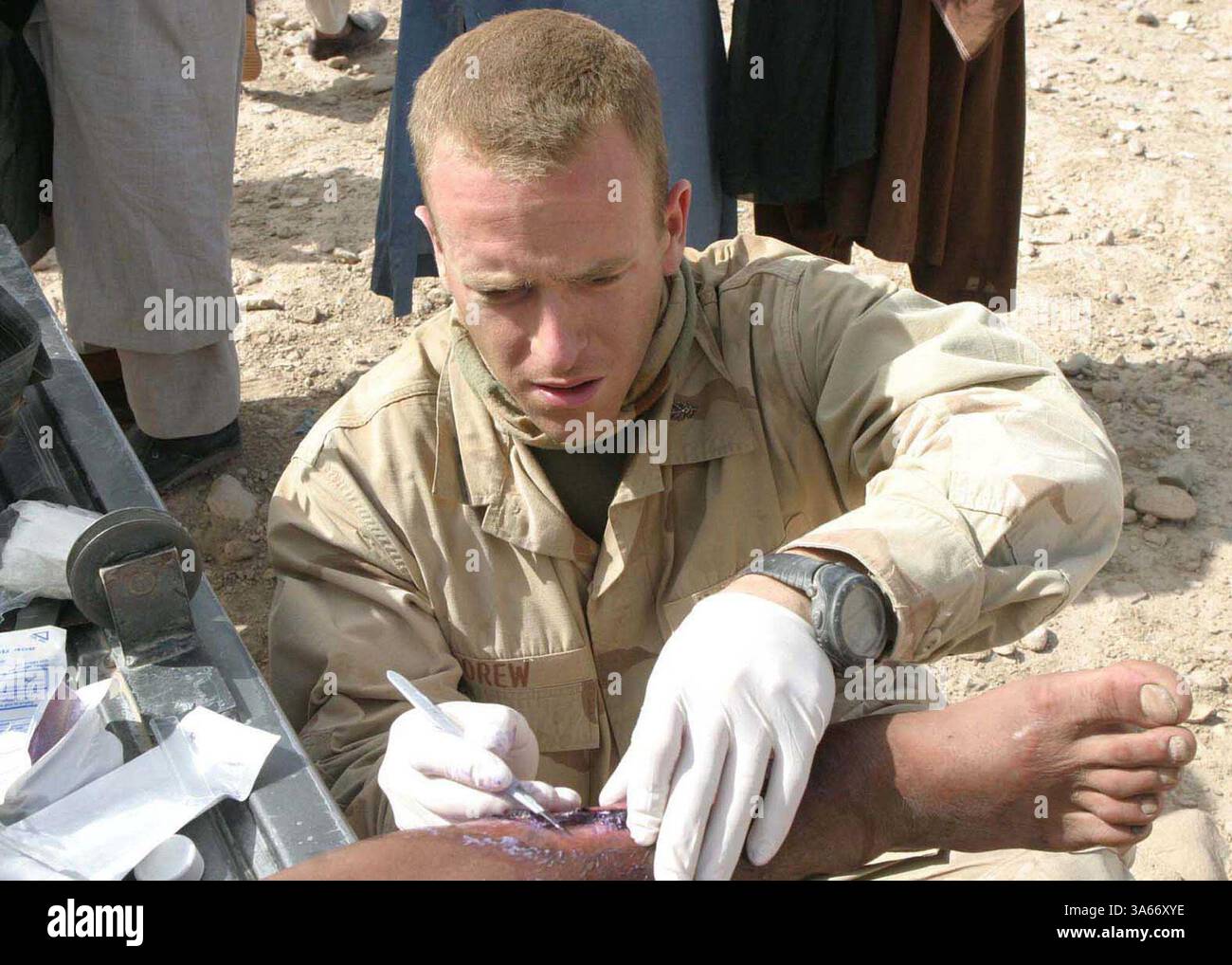 Third degree burn hi-res stock photography and images - Alamy