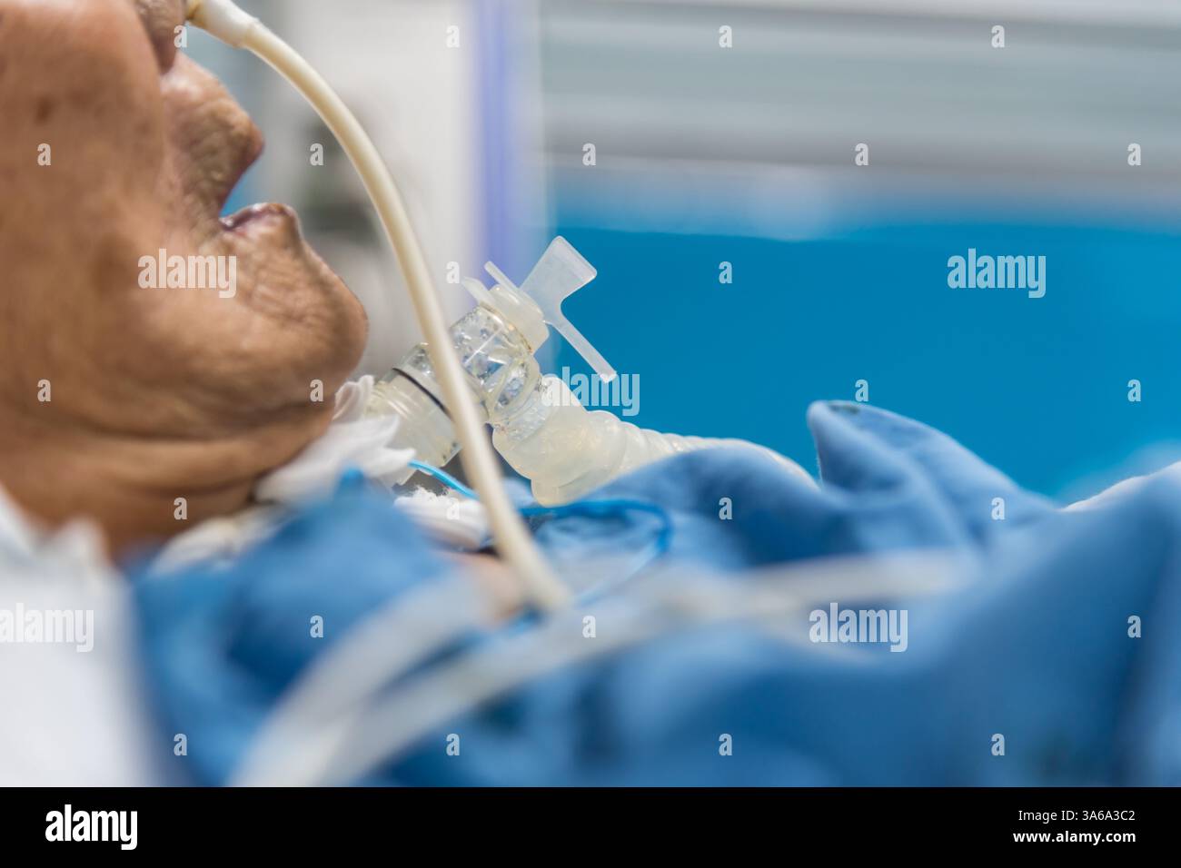 Patient asian elder women 80s do tracheostomy use ventilator for ...