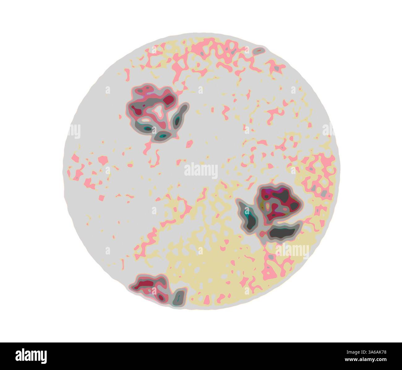 Variations in body patterns hi-res stock photography and images - Alamy