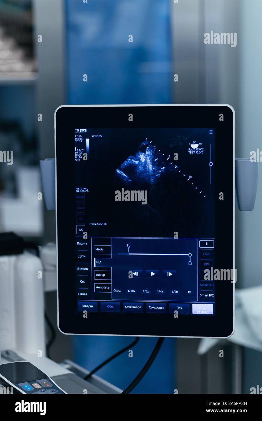 Close-up Ultrasound image on the monitor in the operating room during ...
