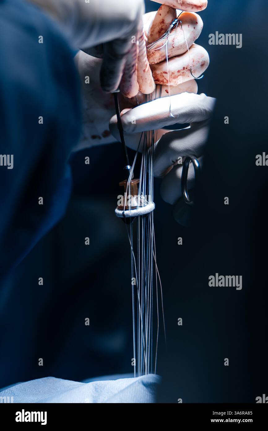 Team of experienced surgeons performing a complex cardiac operation ...