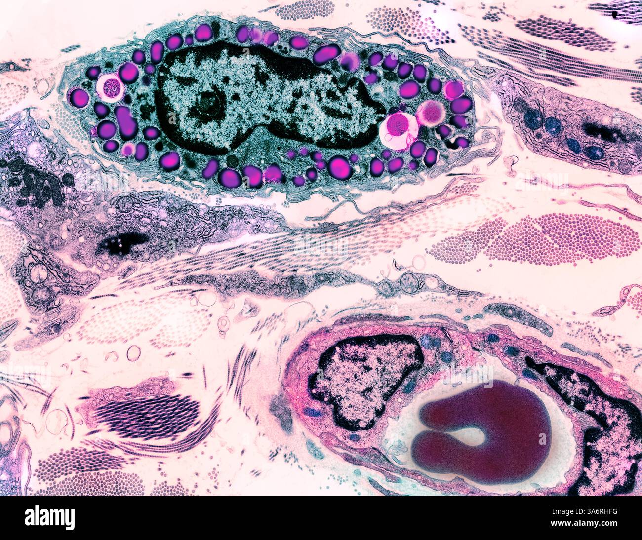 Mast cell. Coloured transmission electron micrograph (TEM) showing a rat mast cell in the skin ...