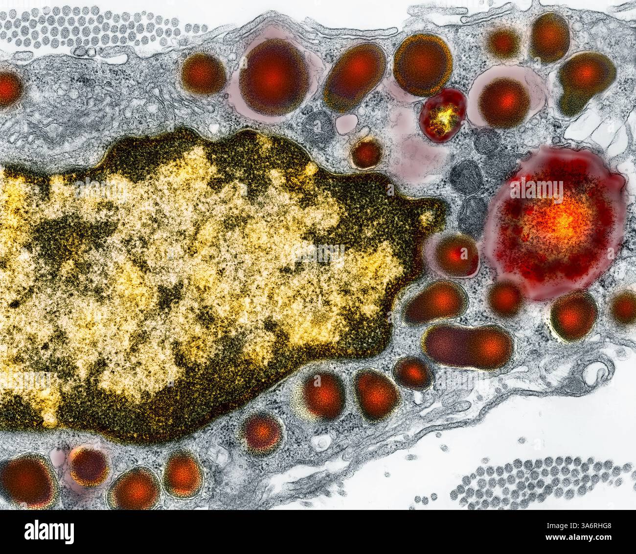 Mast cell, TEM Stock Photo - Alamy