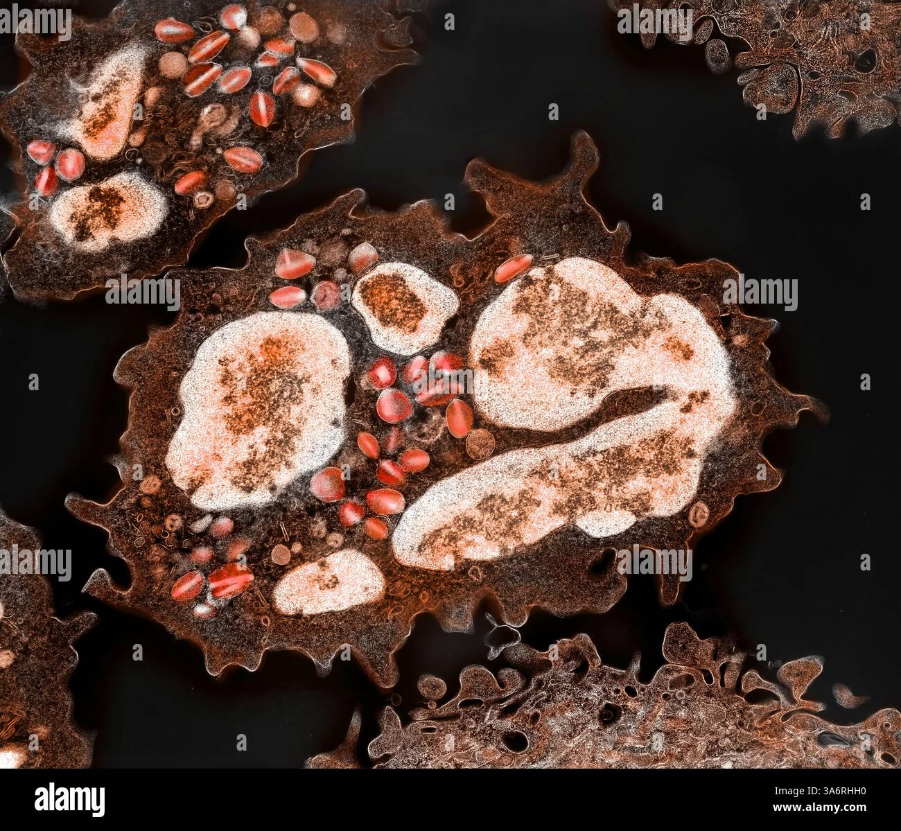 Mouse eosinophils. Coloured transmission electron micrograph (TEM) of ...
