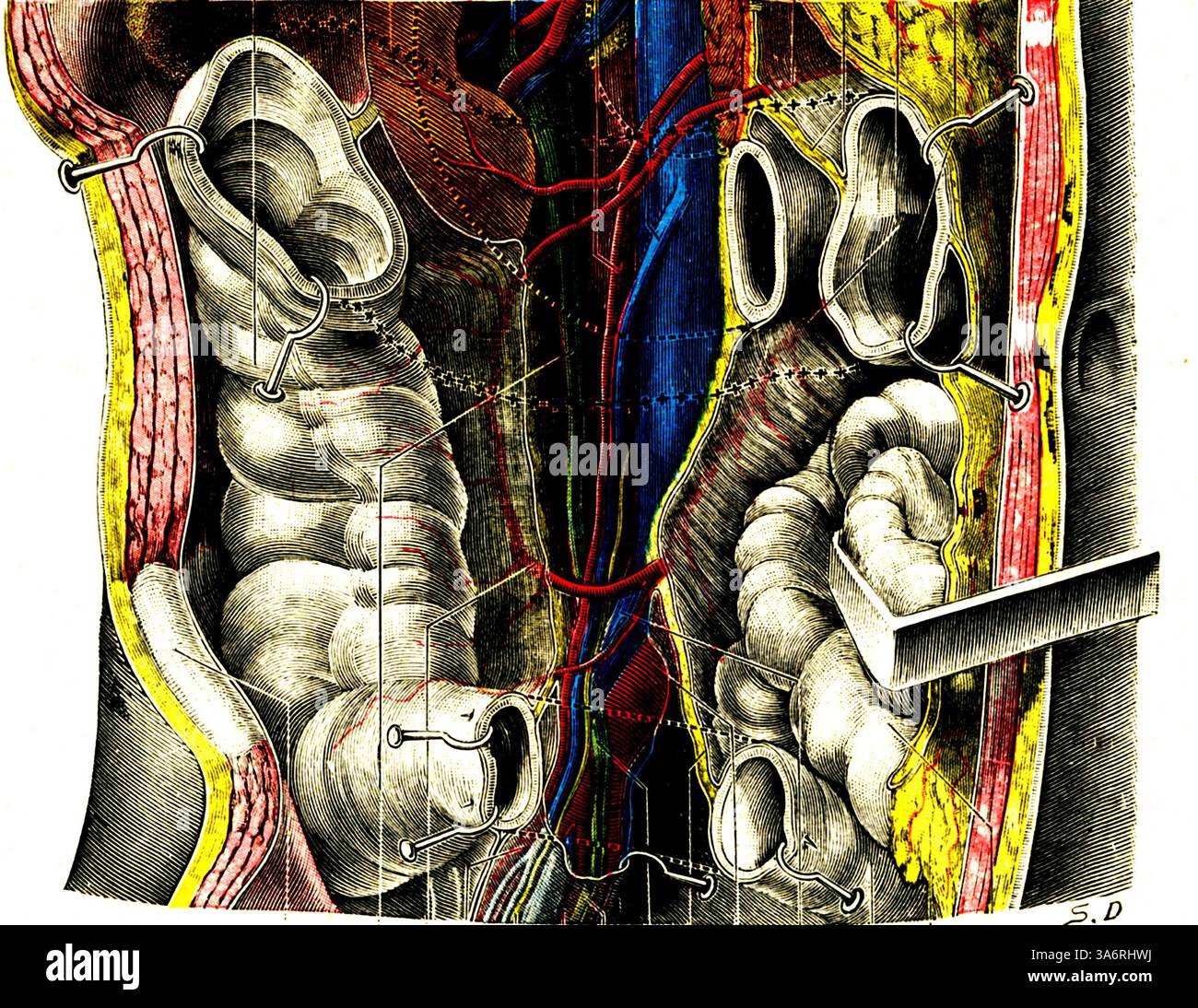 Illustration of the anatomy of the abdomen. Parts of the large ...