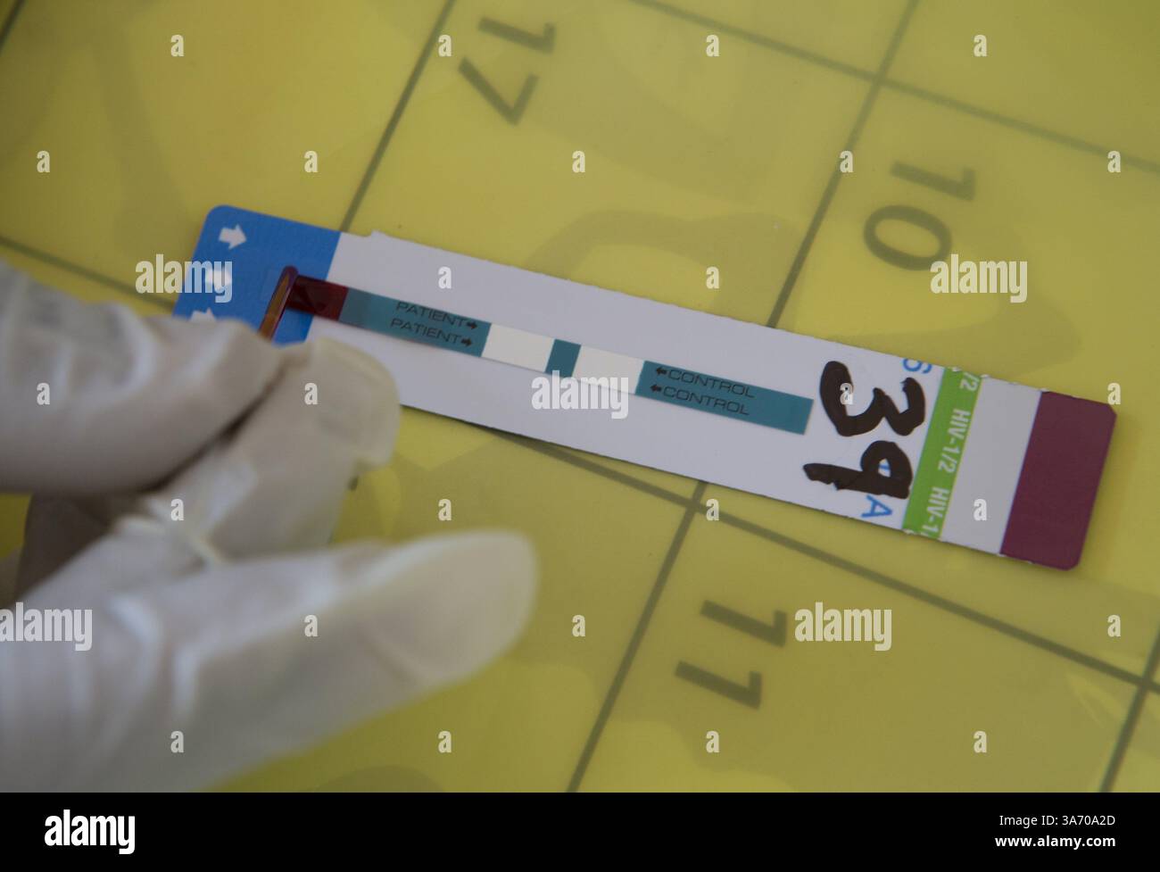 May 14, 2014 - Harare, Zimbabwe - HIV aids testing in Zimbabwe (Credit ...