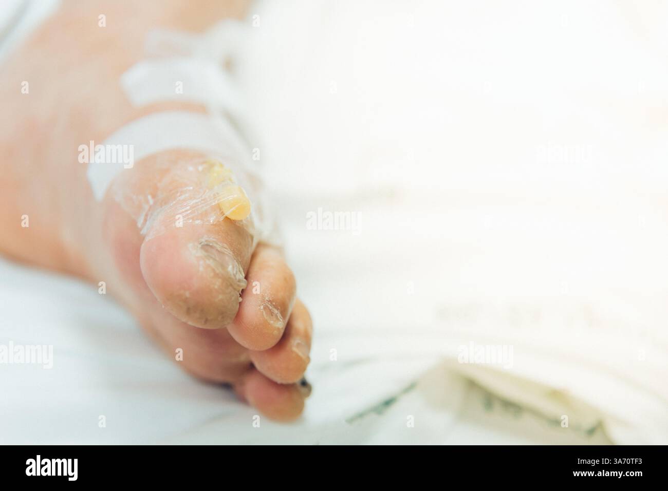 Patient asian elder women 80s with saline intravenous at C-line or A ...