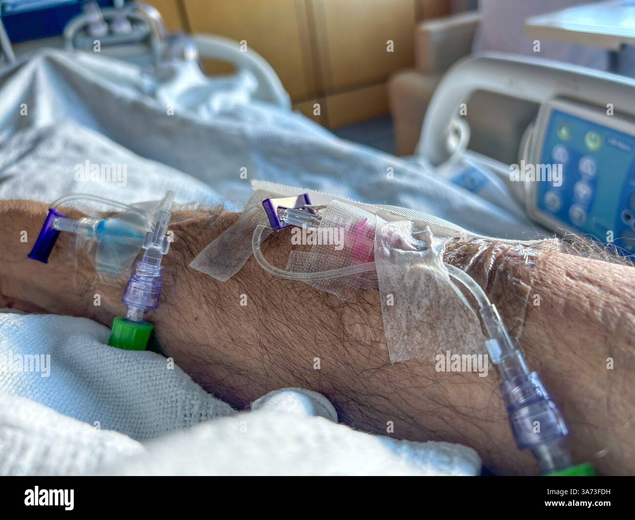 Iv tubing arm hi-res stock photography and images - Alamy