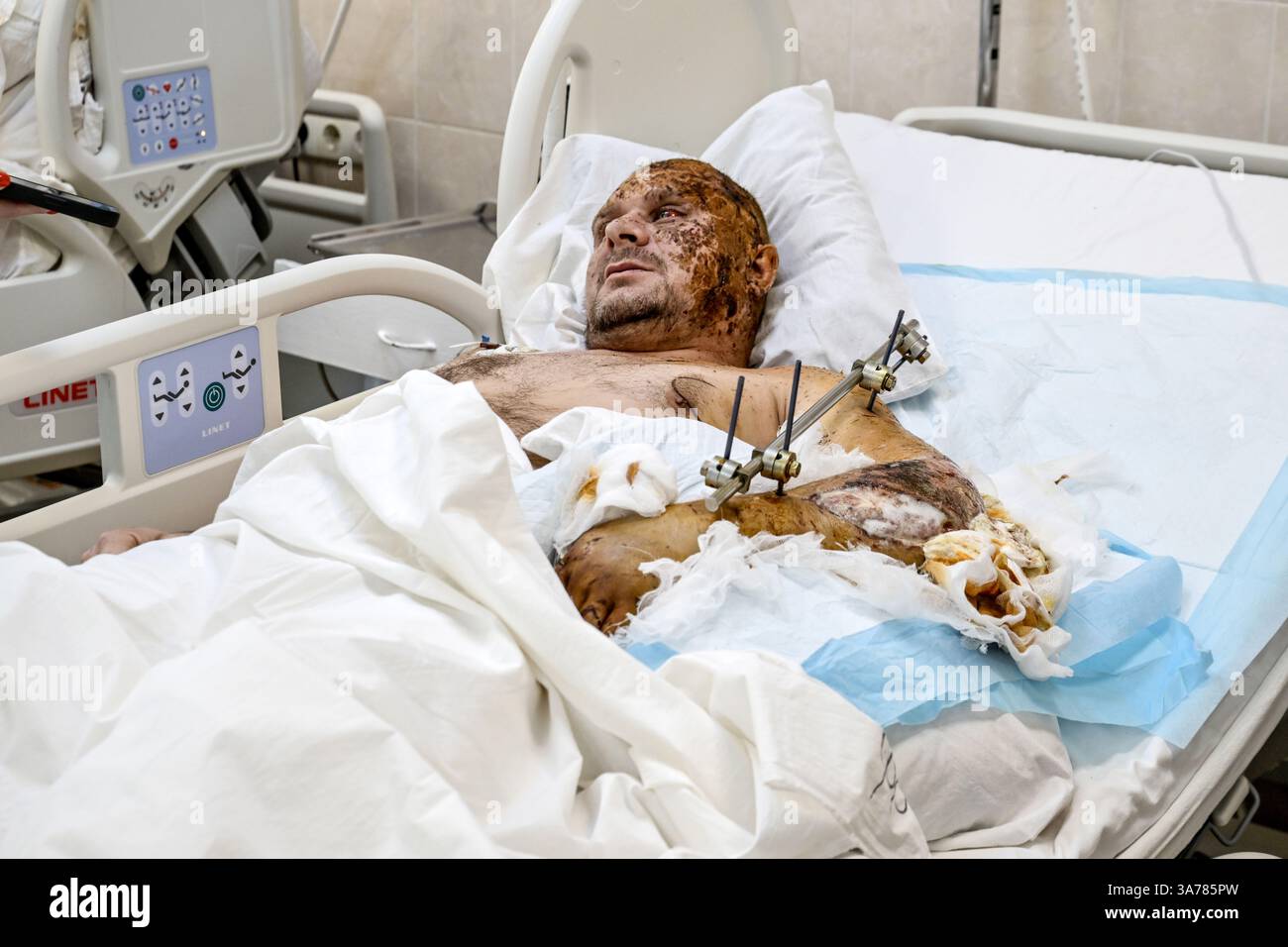 Serviceman with the call sign "Mechanic" is seen in the ward of the ...