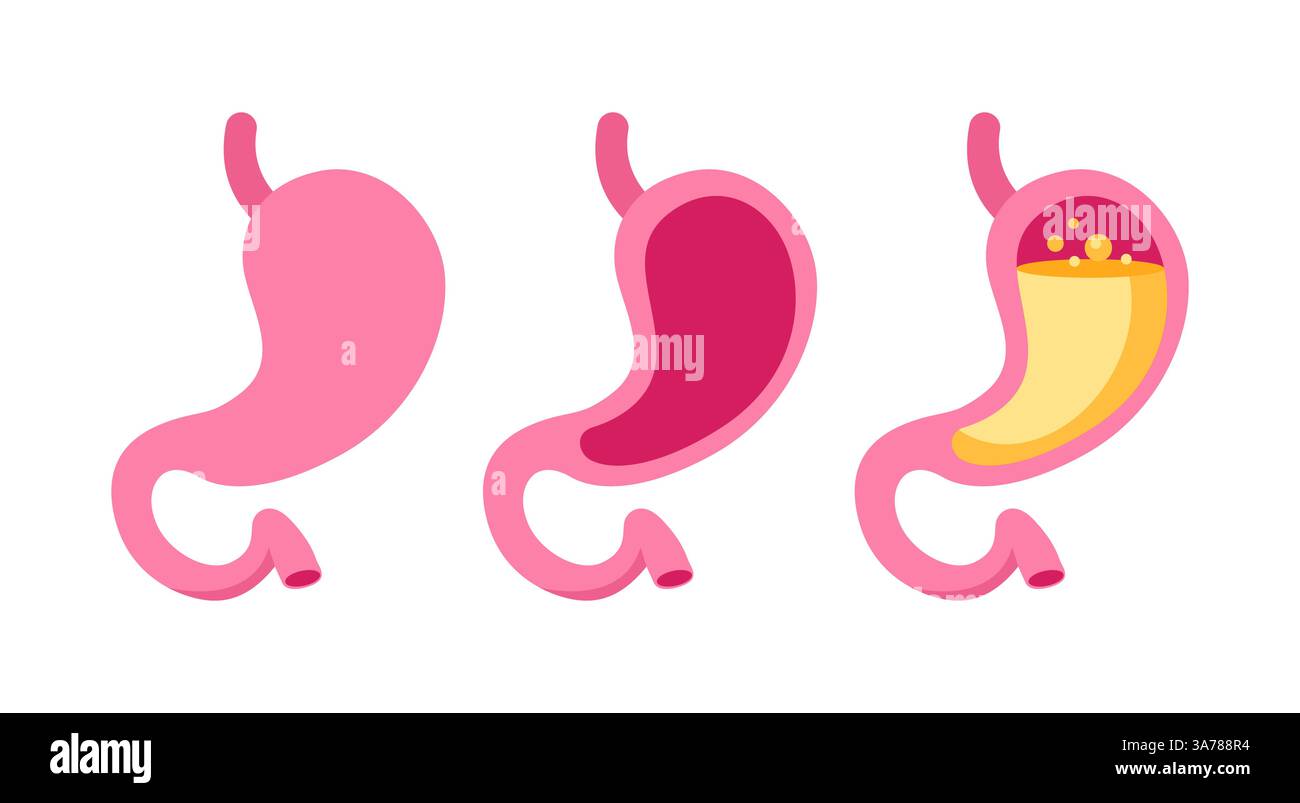 Set of stylized stomach icons in shades of pink, depicting various ...