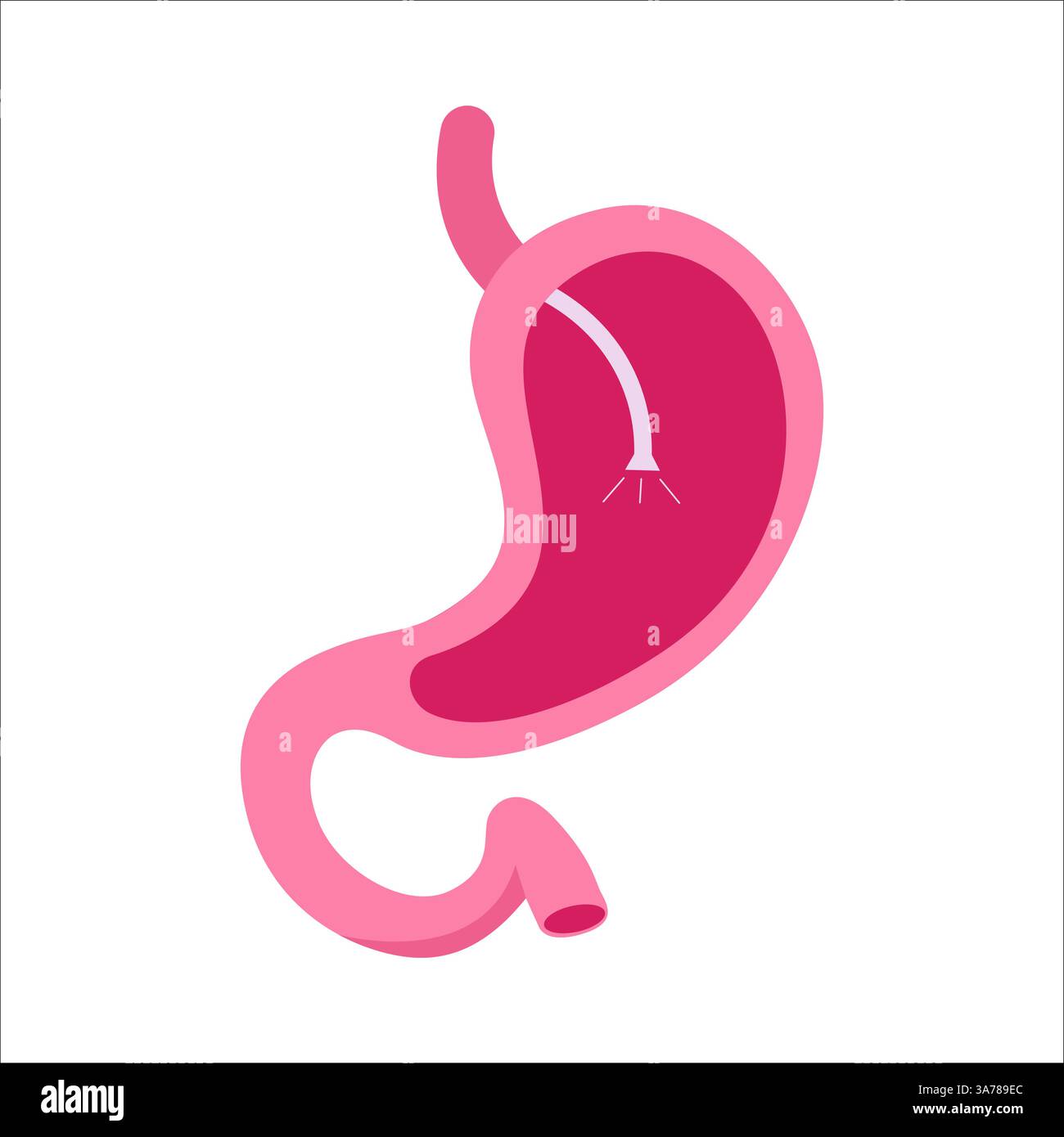 Gastroscopy procedure. Stomach polyps diagnostic. Human gastro. Vector ...