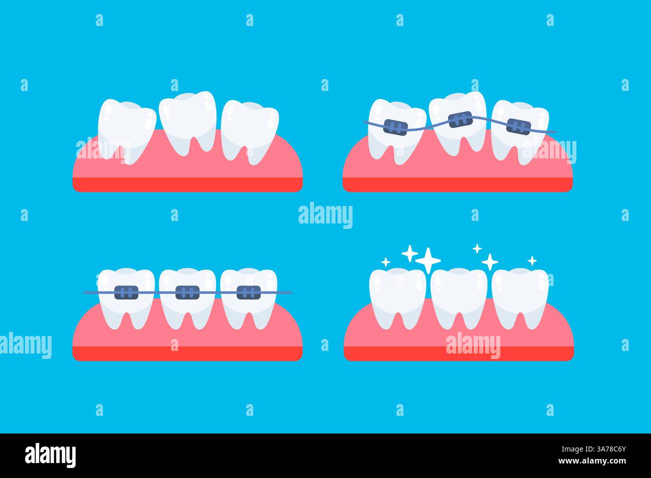 Teeth, orthodontic treatment. Braces on the teeth. Dental care health ...