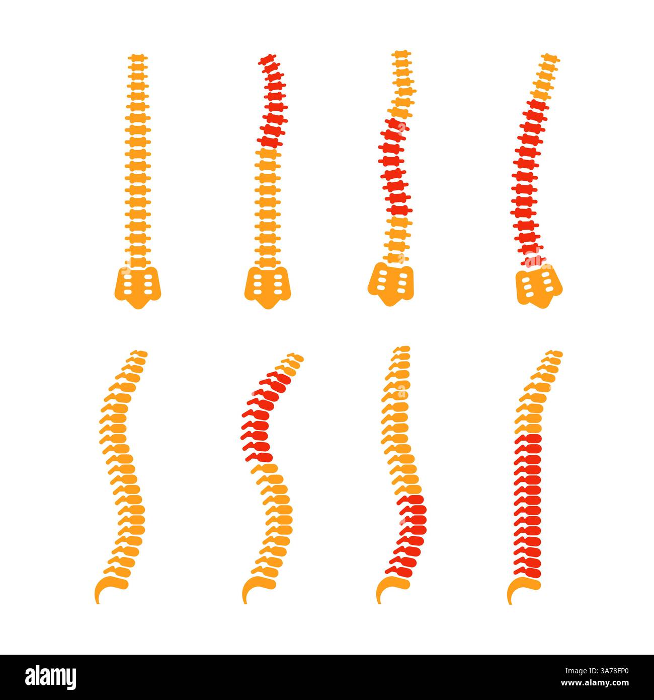 Comparing different human spine shapes with correct and incorrect ...
