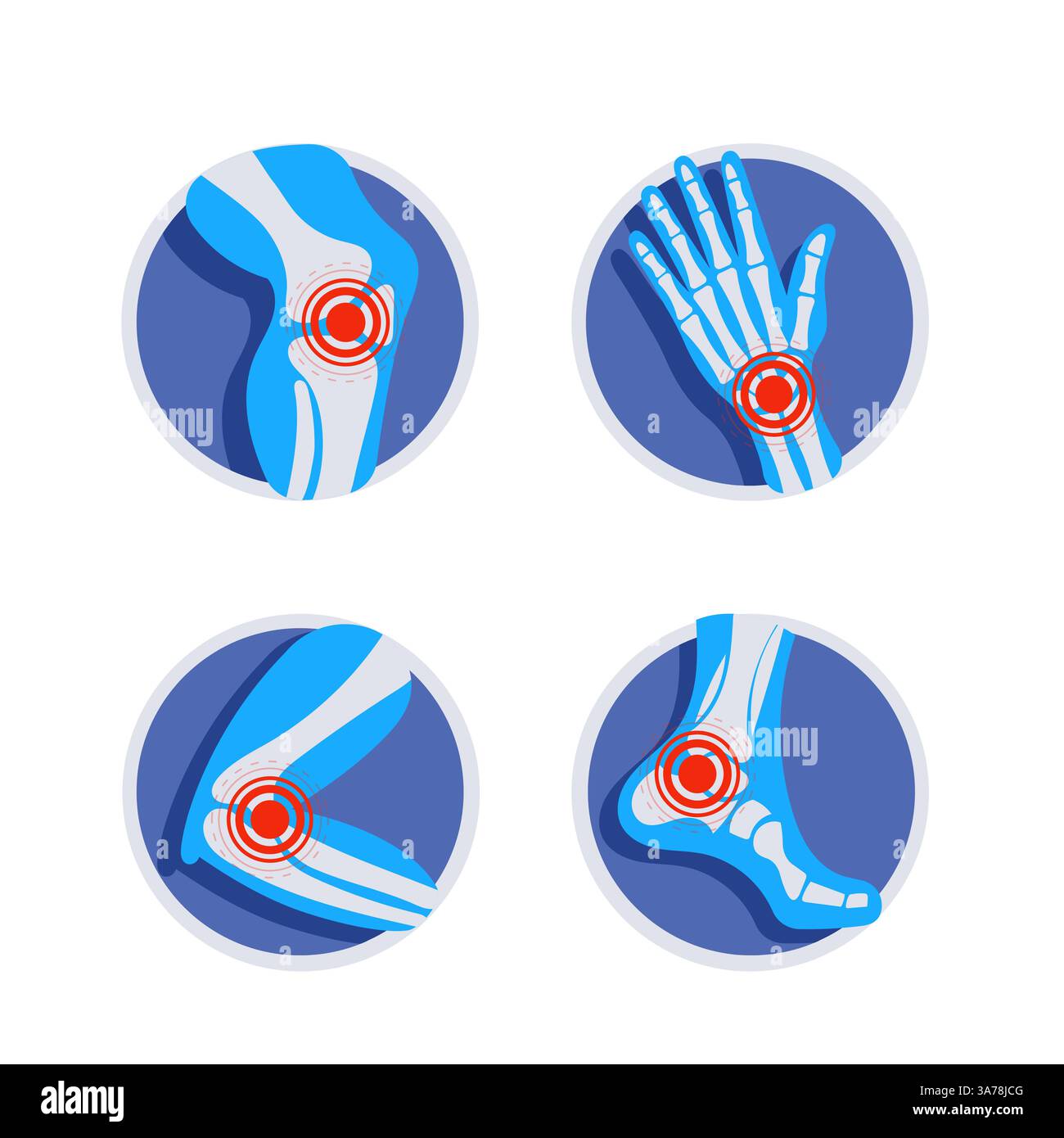 Set of joints pain icons showing symptoms of arthritis, osteoporosis ...