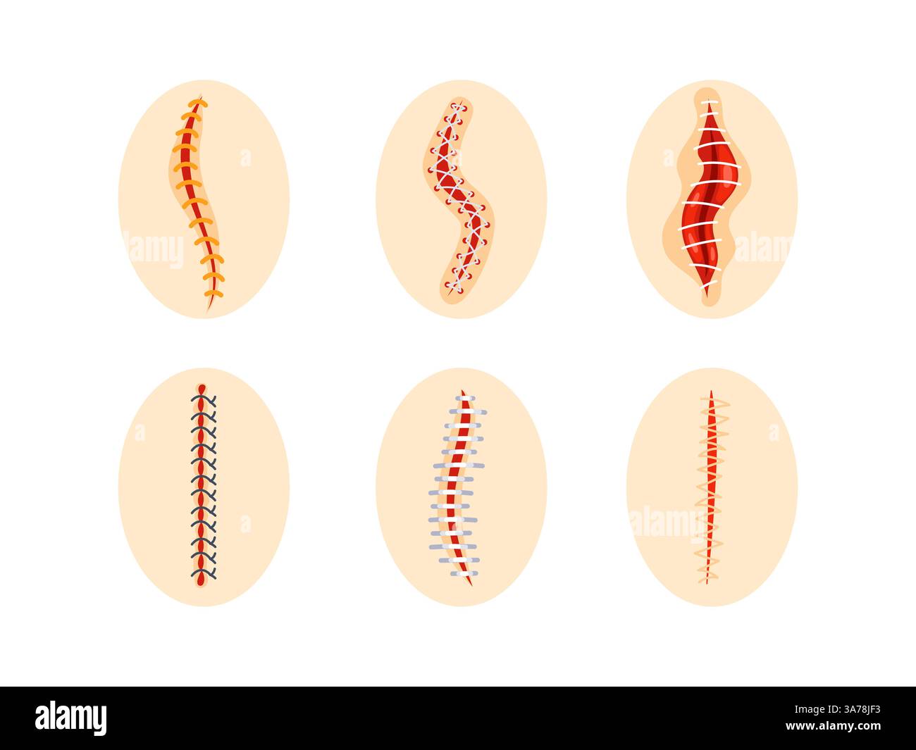 Collection of round icons representing various sutured wounds in different configurations ...